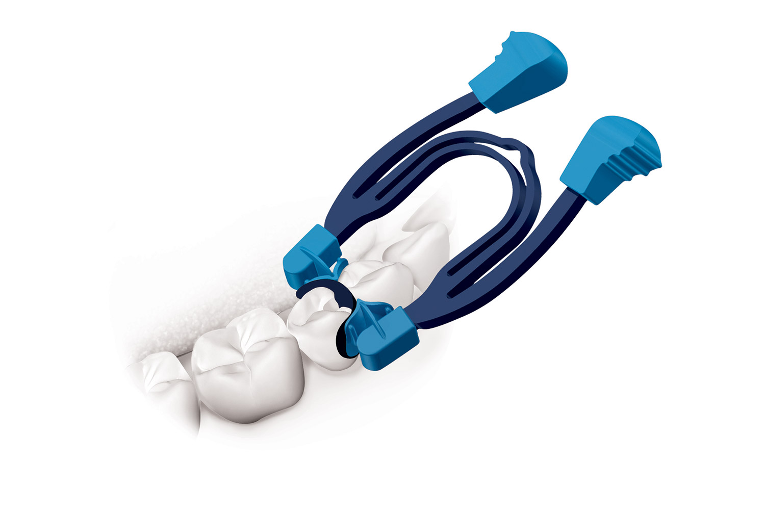 Polydentia | Unica - system formówek i pierścieni • Micerdent